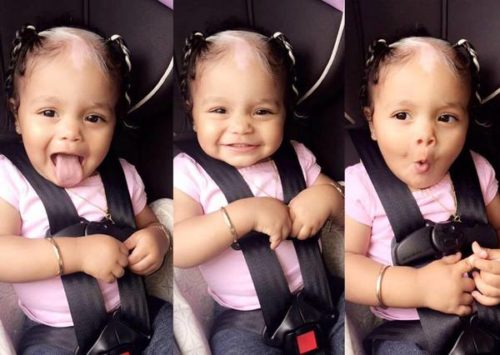 Baby born with white patch of hair is winning the internet