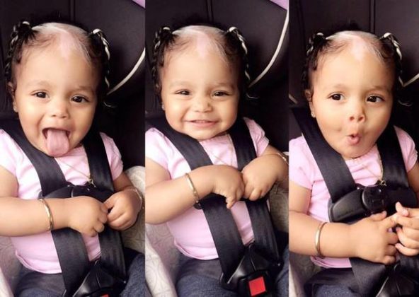 Baby born with white patch of hair is winning the internet