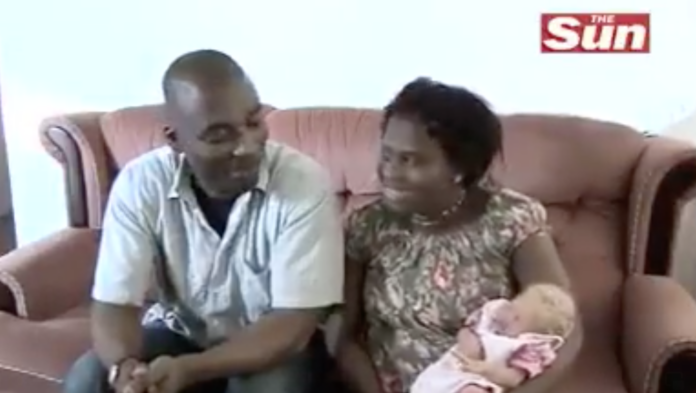 ‘A miracle baby’: Black couple gives birth to a blond, blue-eyed child ...