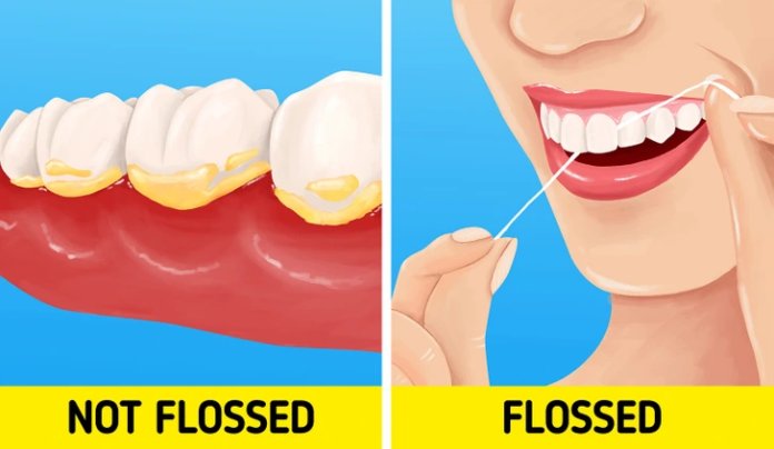 Avoid Bad Breath With These 6 Proven Ways