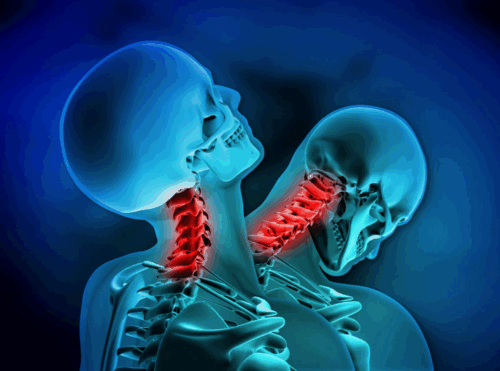 Neck Collapse Alert: Young Man Hospitalized with Dropped Head Syndrome