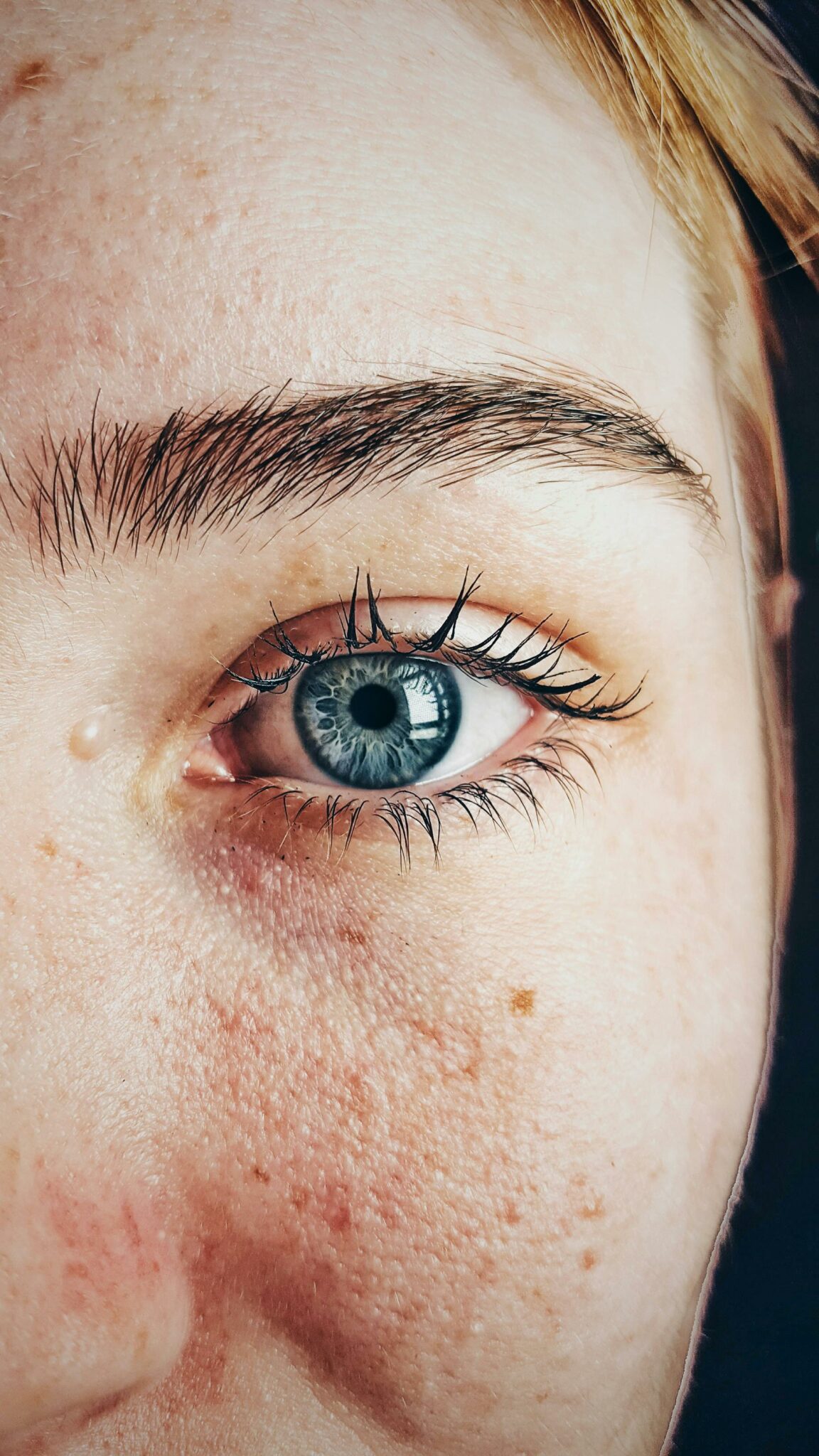 Eye floaters: what they are and what to do if you notice them ...
